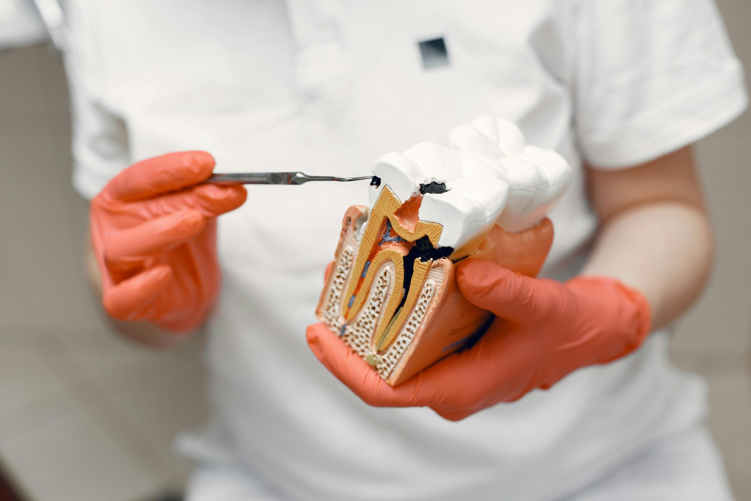 Can You Reverse a Cavity? Early Decay Explained - Cavity Free Living