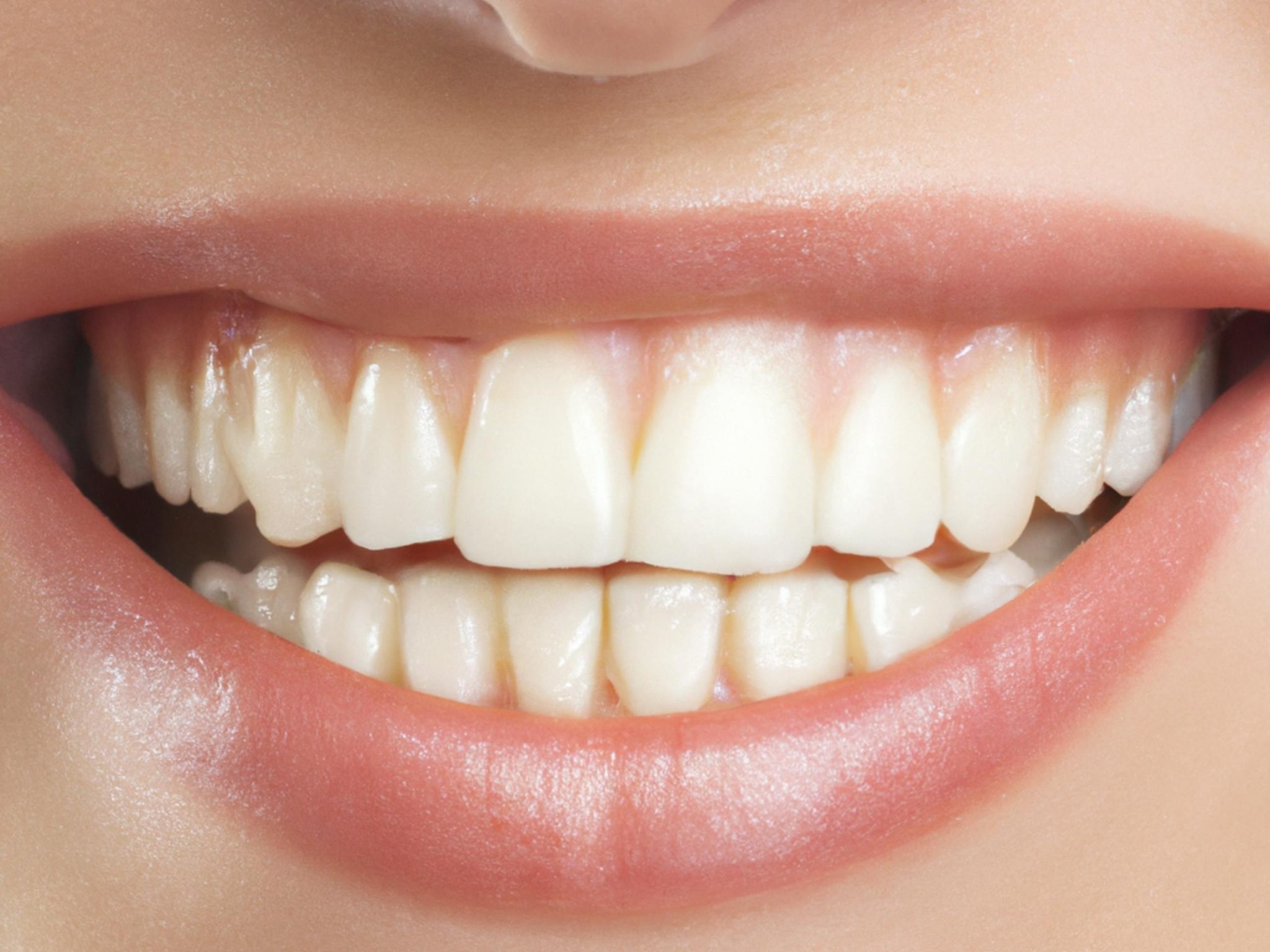 How to Reverse Cavities in 4 Easy Steps - Cavity Free Living